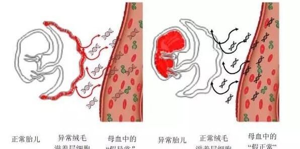 为什么会出现染色体异常的情况 闪电鸟